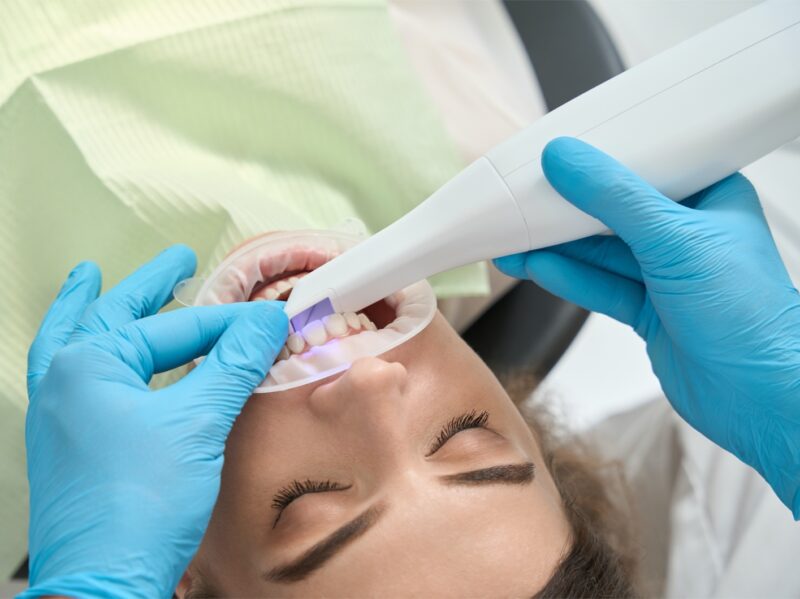 Intraoral scanning – Joseph Barclay